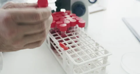 Blood sample, lab test and scientist han... | Stock Video | Pond5