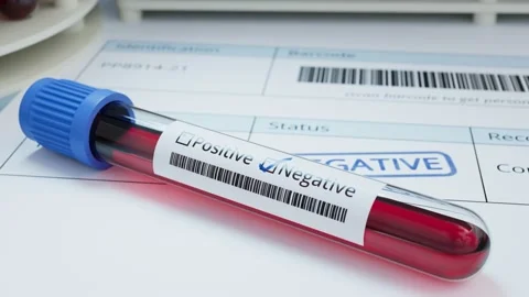 Blood sample with a negative test. Viral... | Stock Video | Pond5