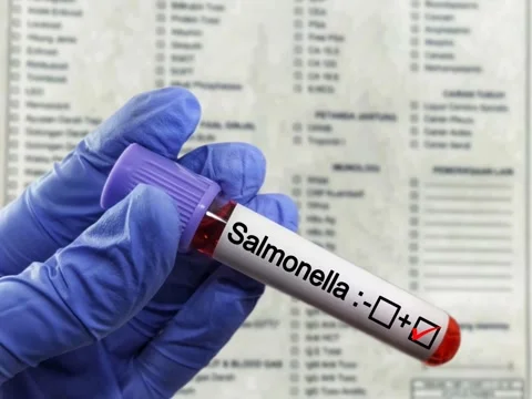 Blood sample for Salmonella bacteria tes... | Stock Video | Pond5