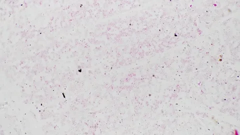 Blood smear magnified under microscope 1... | Stock Video | Pond5