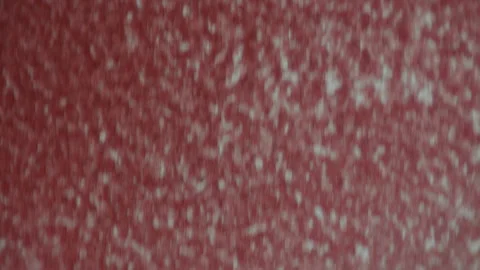 Blood smear under microscope present pla... | Stock Video | Pond5