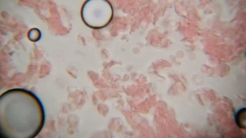 Blood smear under microscope present pla... | Stock Video | Pond5