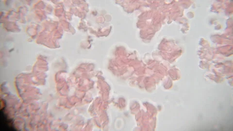 Blood smear under microscope present pla... | Stock Video | Pond5