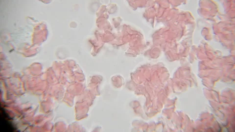 Blood smear under microscope present pla... | Stock Video | Pond5