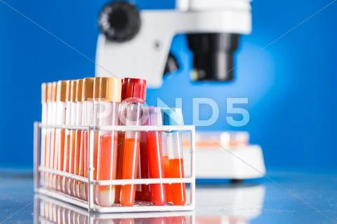 Blood test in medical laboratory, check sugar content red blood cells ...