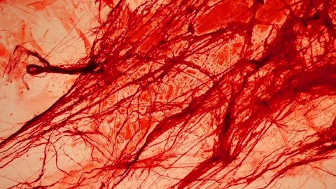 Blood threads background. Hair in blood ... | Stock Video | Pond5