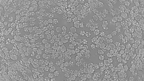 Blood under a microscope, the movement o... | Stock Video | Pond5