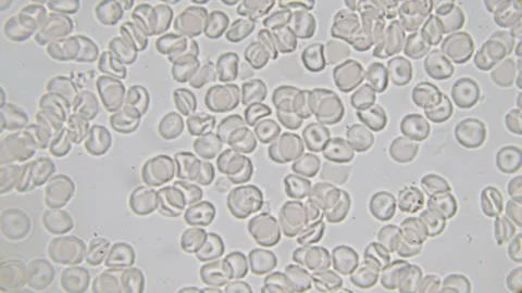 Blood under a microscope shows individua... | Stock Video | Pond5