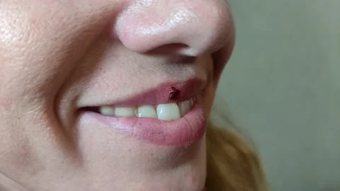 Bloody Lips Stock Videos – Royalty-Free HD & 4K Videos | Pond5