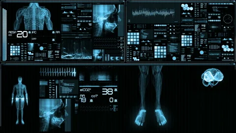 Blue futuristic patient monitor screen i... | Stock Video | Pond5