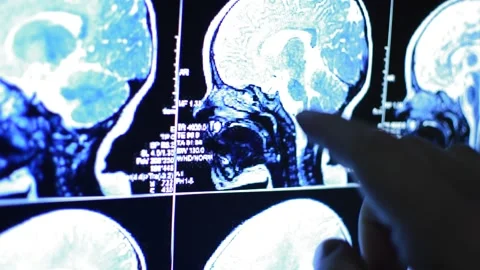 blue mri scan analysis of a human brain.... | Stock Video | Pond5