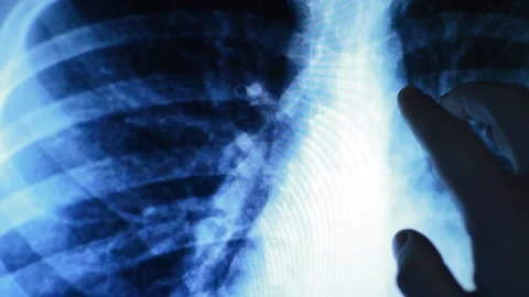 blue mri scan of a human chest. doctor a... | Stock Video | Pond5