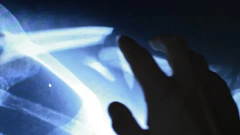 blue mri scan technology of a man in a h... | Stock Video | Pond5