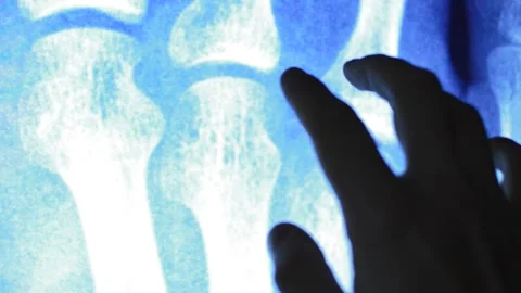 blue mri scan technology of a man in a h... | Stock Video | Pond5
