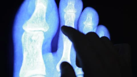 blue mri scan of a x-ray bone foot. medi... | Stock Video | Pond5
