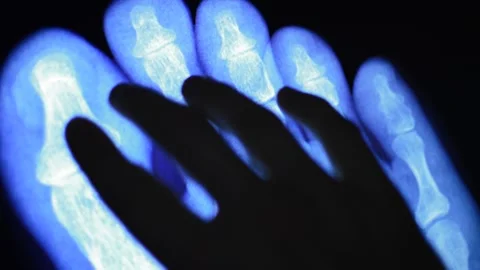 blue mri scan of a x-ray bone foot. medi... | Stock Video | Pond5