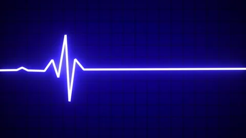 Blue neon ECG pulse rate line. EKG pulse... | Stock Video | Pond5