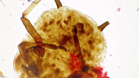 Body of aphis at microscopic slide 100x ... | Stock Video | Pond5