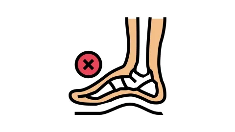 bone postural deformity feet color icon ... | Stock Video | Pond5