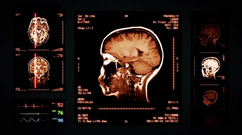 Brain, Knee and Neck MRI Scan. Amber. 3 ... | Stock Video | Pond5
