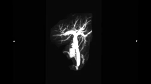 Brain MRI Angiography (Magnetic Resonanc... | Stock Video | Pond5