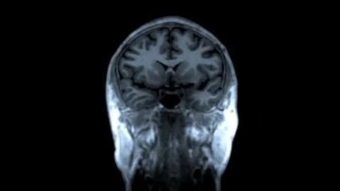 Brain MRI scan visualisation animation. | Stock Video | Pond5