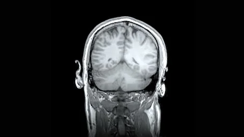 Brain MRI scan visualisation animation. | Stock Video | Pond5