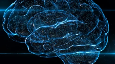 Brain neurons misfiring causing Mental i... | Stock Video | Pond5