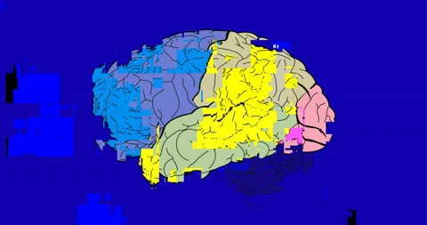 Brain picture animation with glitch effe... | Stock Video | Pond5