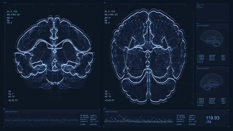 Brain scan screen animation. Device scan... | Stock Video | Pond5