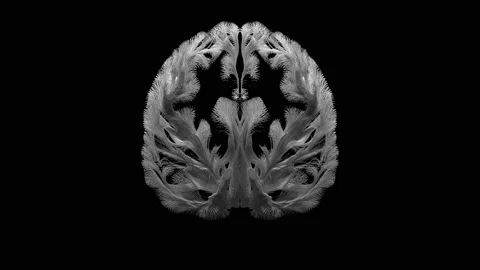 Brain slices sequence, mapping axons dir... | Stock Video | Pond5