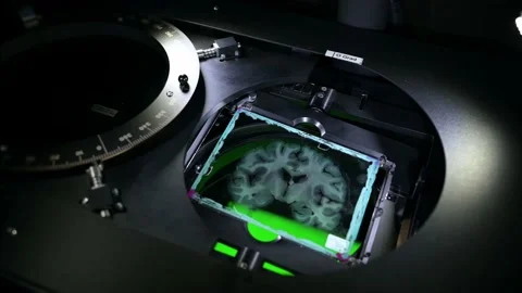 Brain slide in laboratory microscope | Stock Video | Pond5