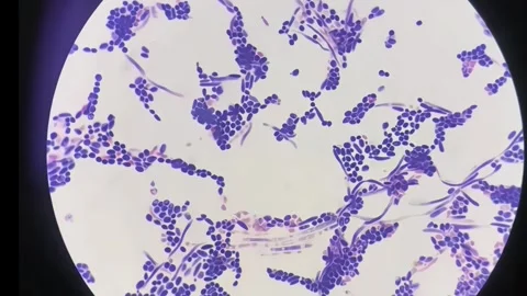 Branching budding yeast cells with pseud... | Stock Video | Pond5