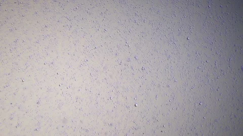 Breast Milk under a Microscope 02 | Stock Video | Pond5