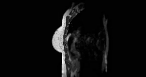 Breast Imaging Stock Footage ~ Royalty Free Stock Videos | Pond5