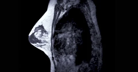 Breast Imaging Stock Footage ~ Royalty Free Stock Videos | Pond5