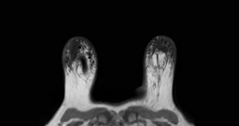 Breast Imaging Stock Footage ~ Royalty Free Stock Videos | Pond5