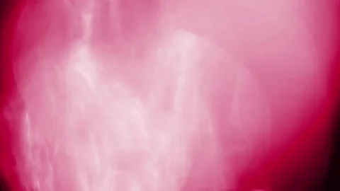 Bright pink light leak film damage burns... | Stock Video | Pond5