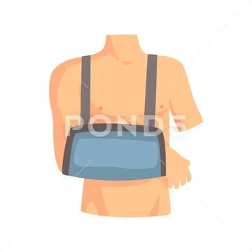 Broken arm with a plaster cast cartoon vector Illustration Illustration ...