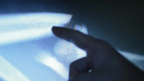 broken bone x ray mri scan. doctor monit... | Stock Video | Pond5