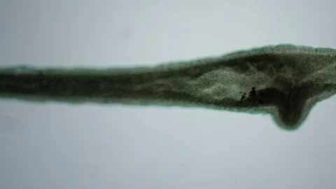 Budding. Hydra reproduction under a micr... | Stock Video | Pond5