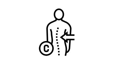 S Shaped Scoliosis Stock Videos – Royalty-Free HD & 4K Videos | Pond5