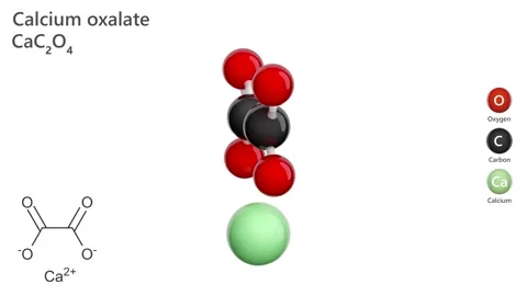 Calcium Oxalate. Kidney stones. 3D model... | Stock Video | Pond5