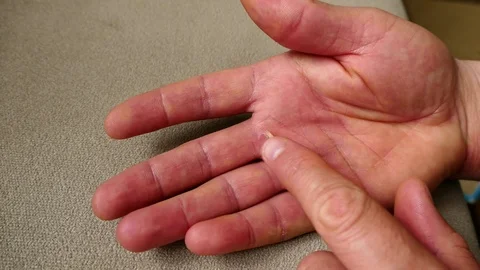 calluses formed hands, the hands of work... | Stock Video | Pond5