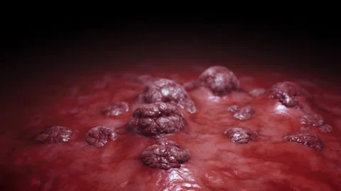 Cancer cell growth animation. | Stock Video | Pond5