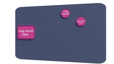Cancer Cell Infographic, Lung Cancer Cel... | Stock Video | Pond5