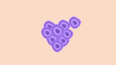 Cancer Cells forming Tumor in human body... | Stock Video | Pond5