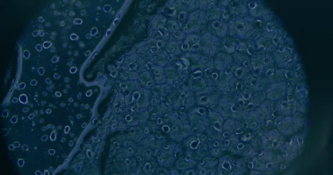Cancer Cells Under Microscope At Laborat... | Stock Video | Pond5