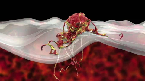 Cancerous tumour invading tissues, anima... | Stock Video | Pond5