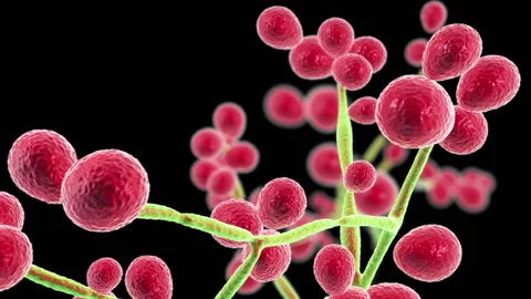 Yeast Infection Stock Video Footage | Royalty Free Yeast Infection ...